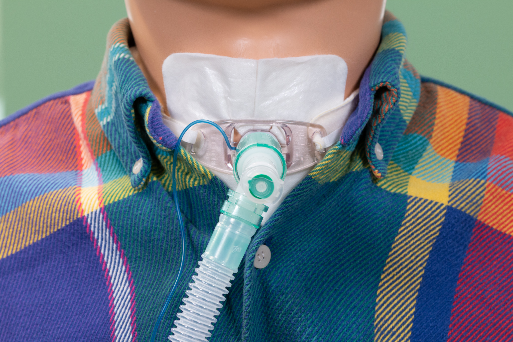 Considering a tracheostomy - myBreathing